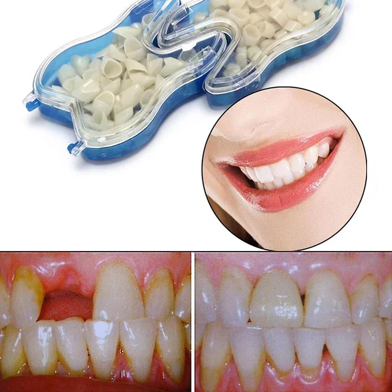 60PCS-Temporary-Denture-Braces-Occlude-Upper-Dentures-Veneer-Dentures ...
