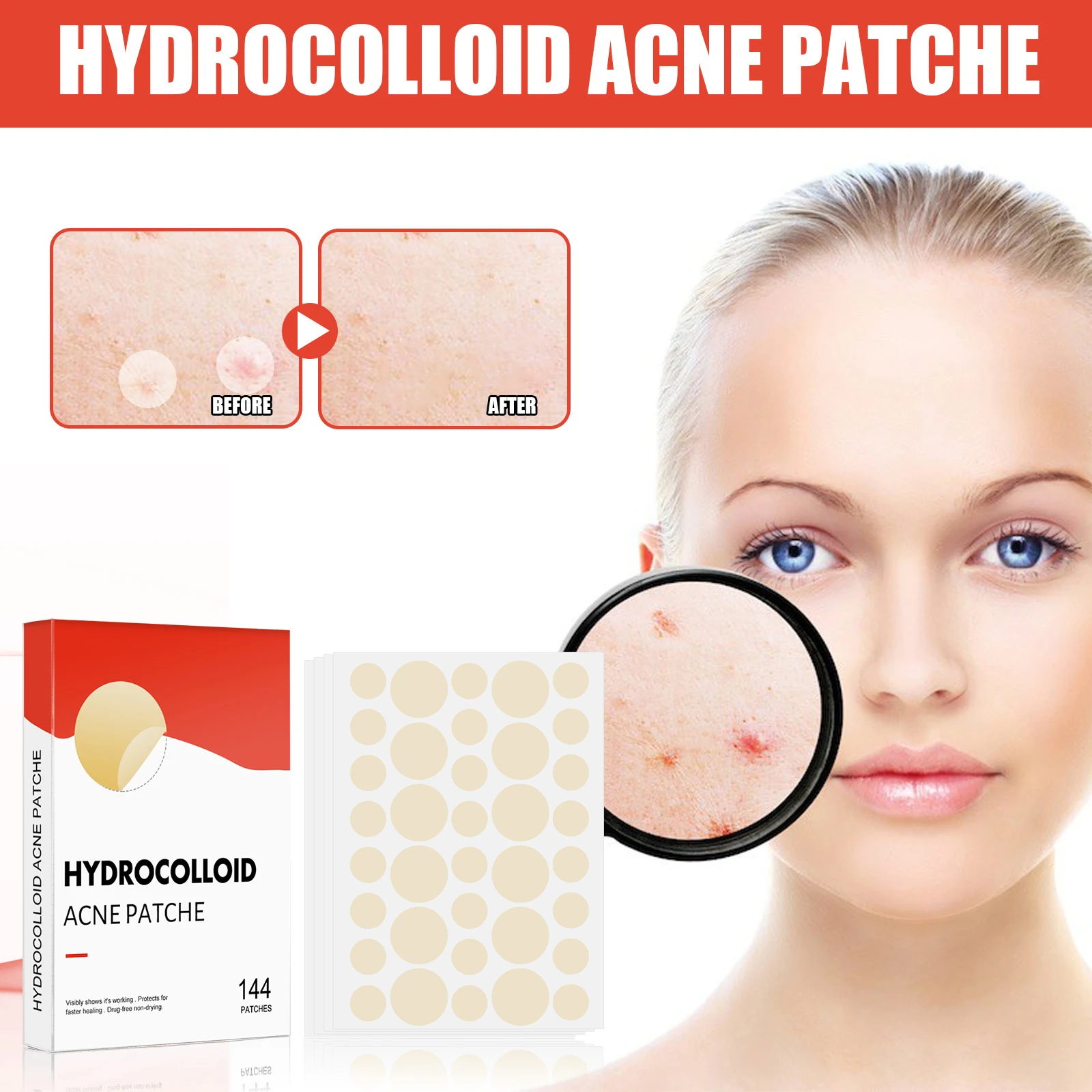 Hydrocolloid-Acne-Patch-Invisible-Closed-Acne-Patch-Invisible-Acne-Face ...