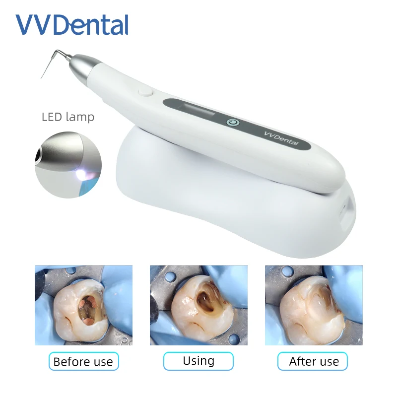 VVDental-irrigador-s-nico-de-odontolog-a-activador-de-endodoncia-para-limpieza-de-Canal ...