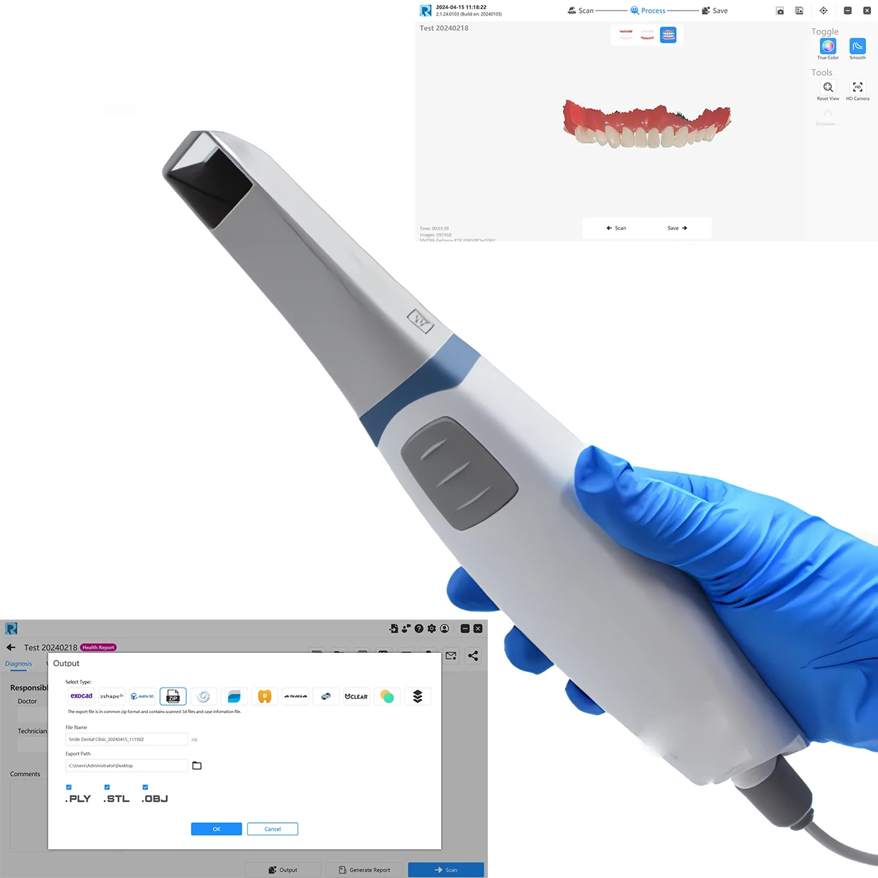 CE Approved Dental 3DS V3 Pro Intraoral Scanner IOS-11 with Free ...
