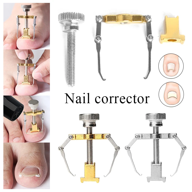 Nail-Pedicure-Tools-Straightening-Clip-Ingrown-Toenail-Tool-Foot-Nail ...