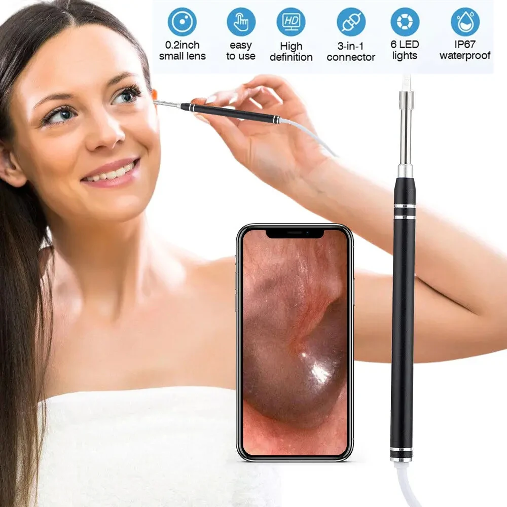 1-Set-Ear-Cleaning-Endoscope-Smart-Visual-Earpick-Mini-Camera-Wireless ...