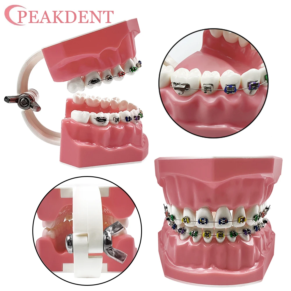 Orthodontic Model: The Essential Tool for Dental Students and Clinicians
