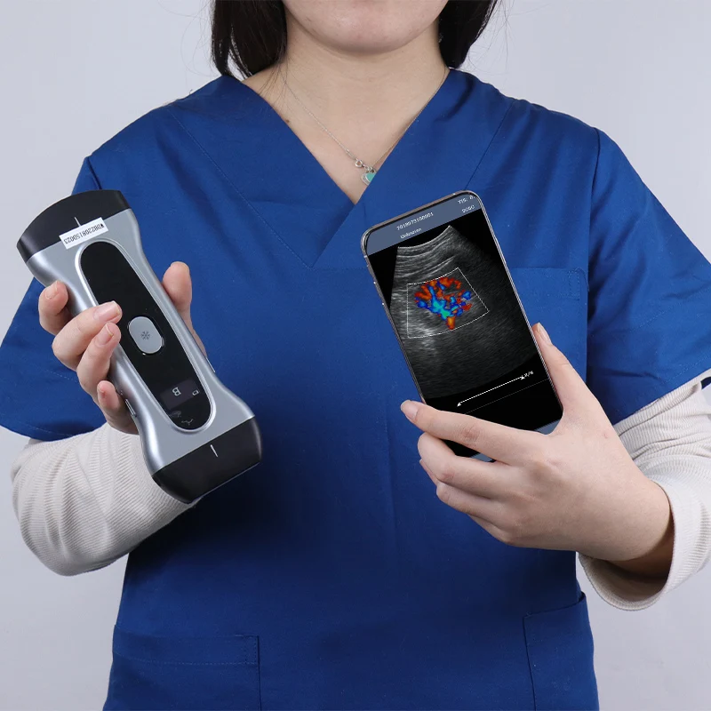 wifi-wireless-mini-Double-probe-cow-pet-Vet-handheld-pregnancy-scanner ...