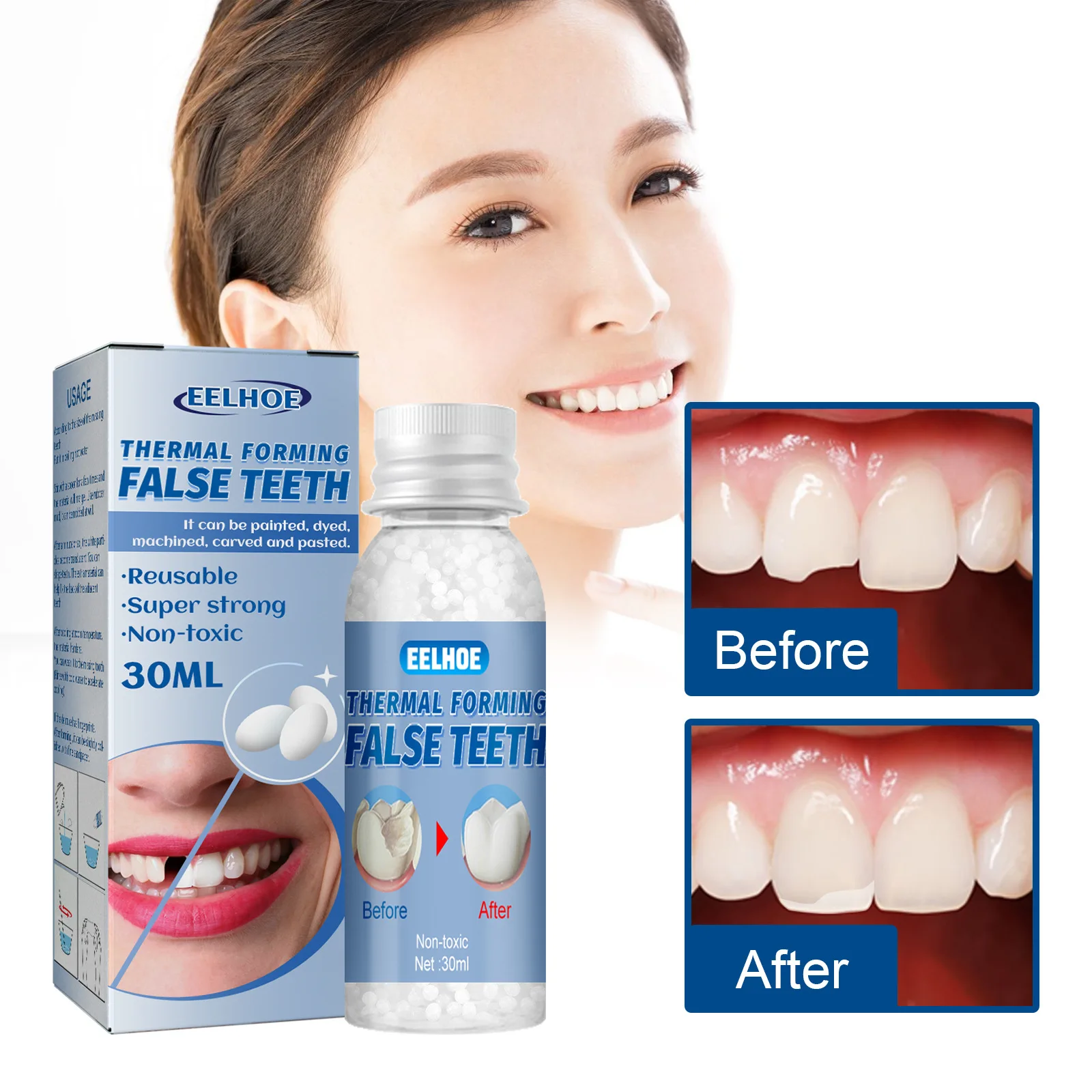 Dientes-postizos-moldeables-con-formaci-n-t-rmica-dientes-postizos ...