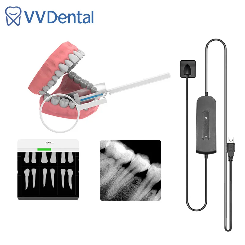 Dental-Sensor-RVG-Intraoral-Imaging-System-Digital-Sensor-X-Ray-For ...