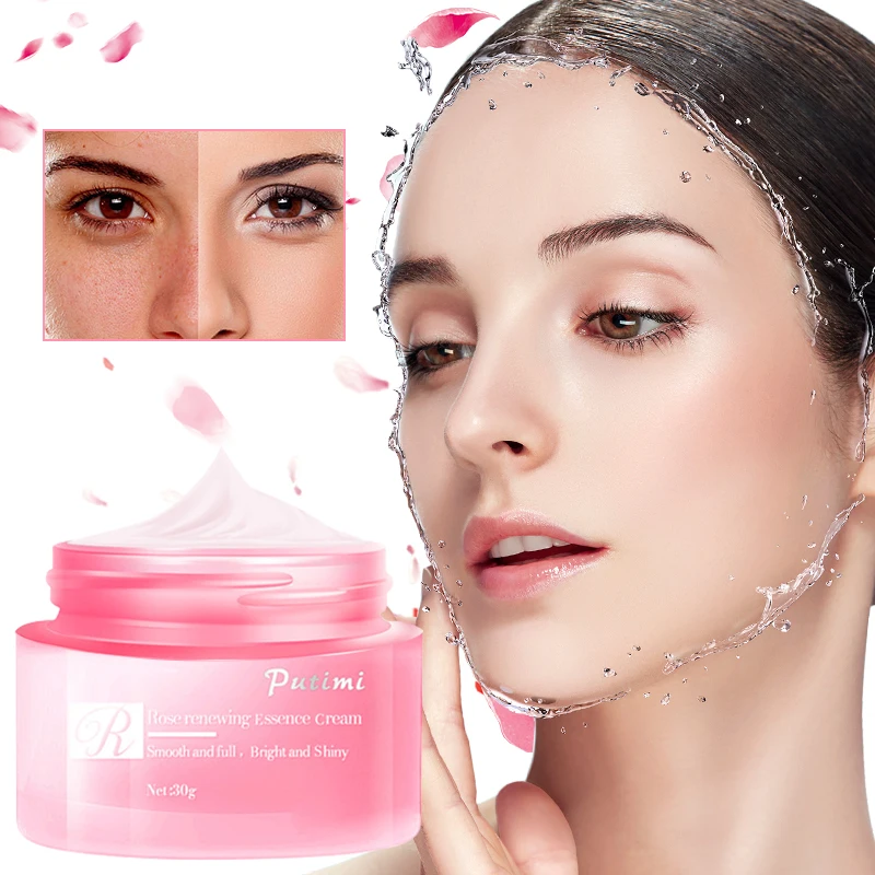 Face Whitening Creams Remove Dark Spots Fade Acne Scars Melanin Freckle ...