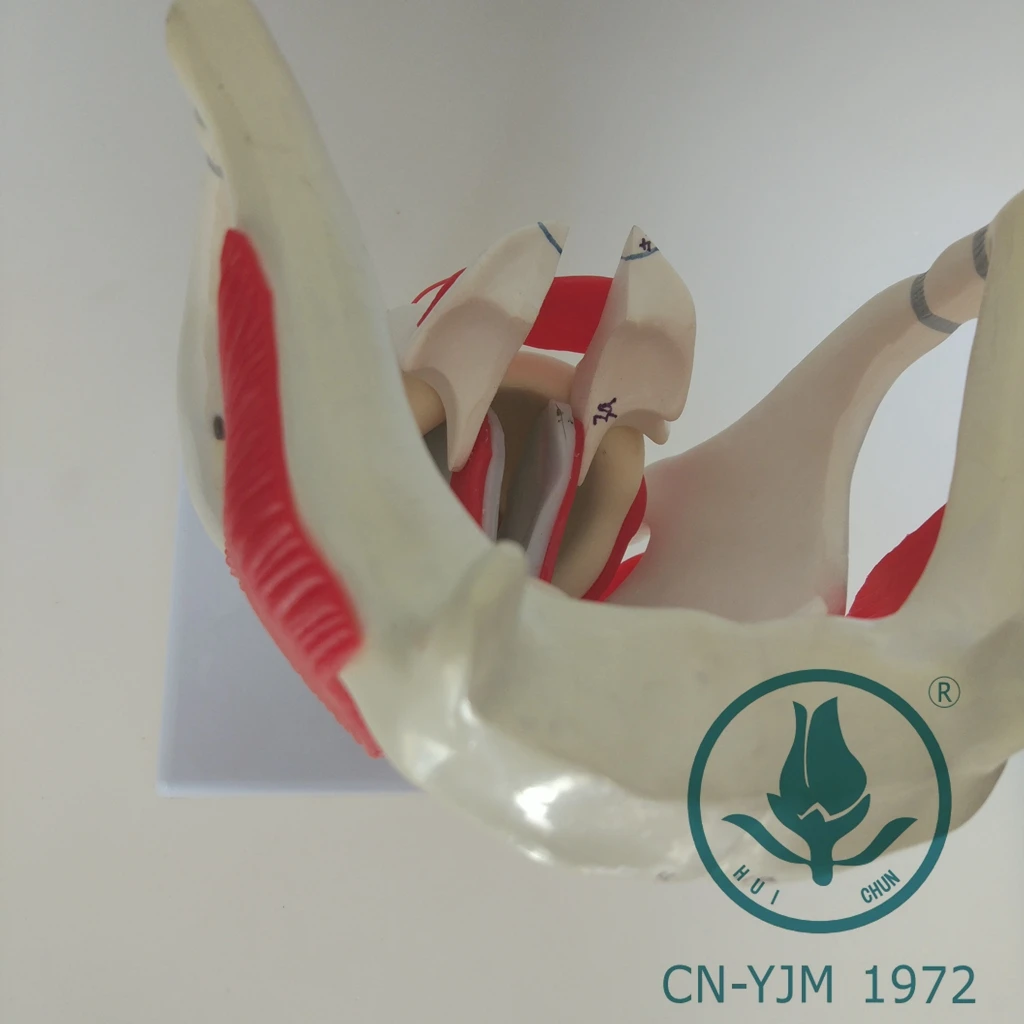 Laryngeal Anatomy Model Functionally amplified vocal cord vocalization ...