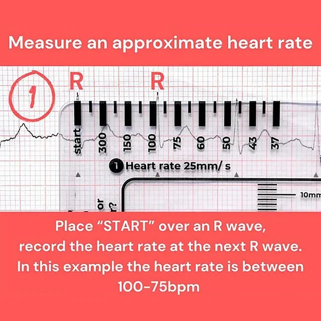 7 Pasos De Ecg Pdf ECG Regla De 7 Pasos, Regla De 7 Pasos De ECG Para Interpretación De ECG/ECG ...