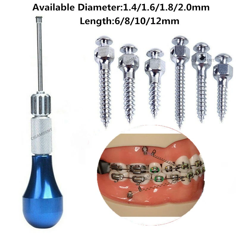 Dental-Orthodontic-Mini-Implant-Micro-Screws-Titanium-Alloy-Implant ...