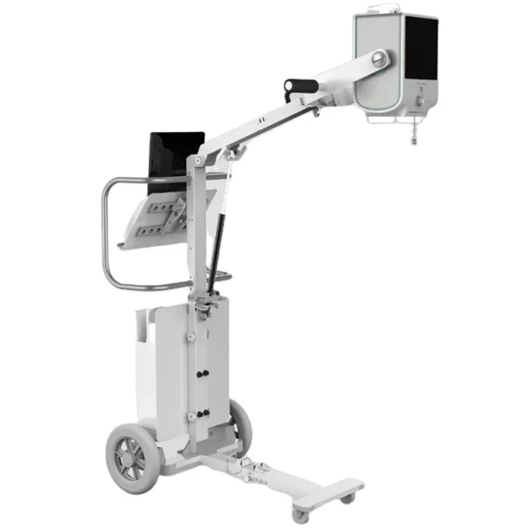 X-Ray-Images-Portable-Digital-Radiograph-Digital-Mobile-X-Ray-System ...