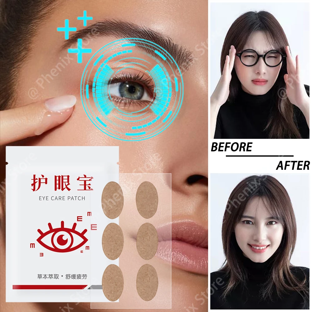 Fast Myopia Treatment Herbal Eye Patch 30Days Acupoint Therapy Rapid ...