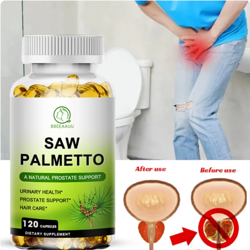 BBEEAAUU Saw Palm Capsule Help Prostate Health Prevent DHT Hair Loss ...