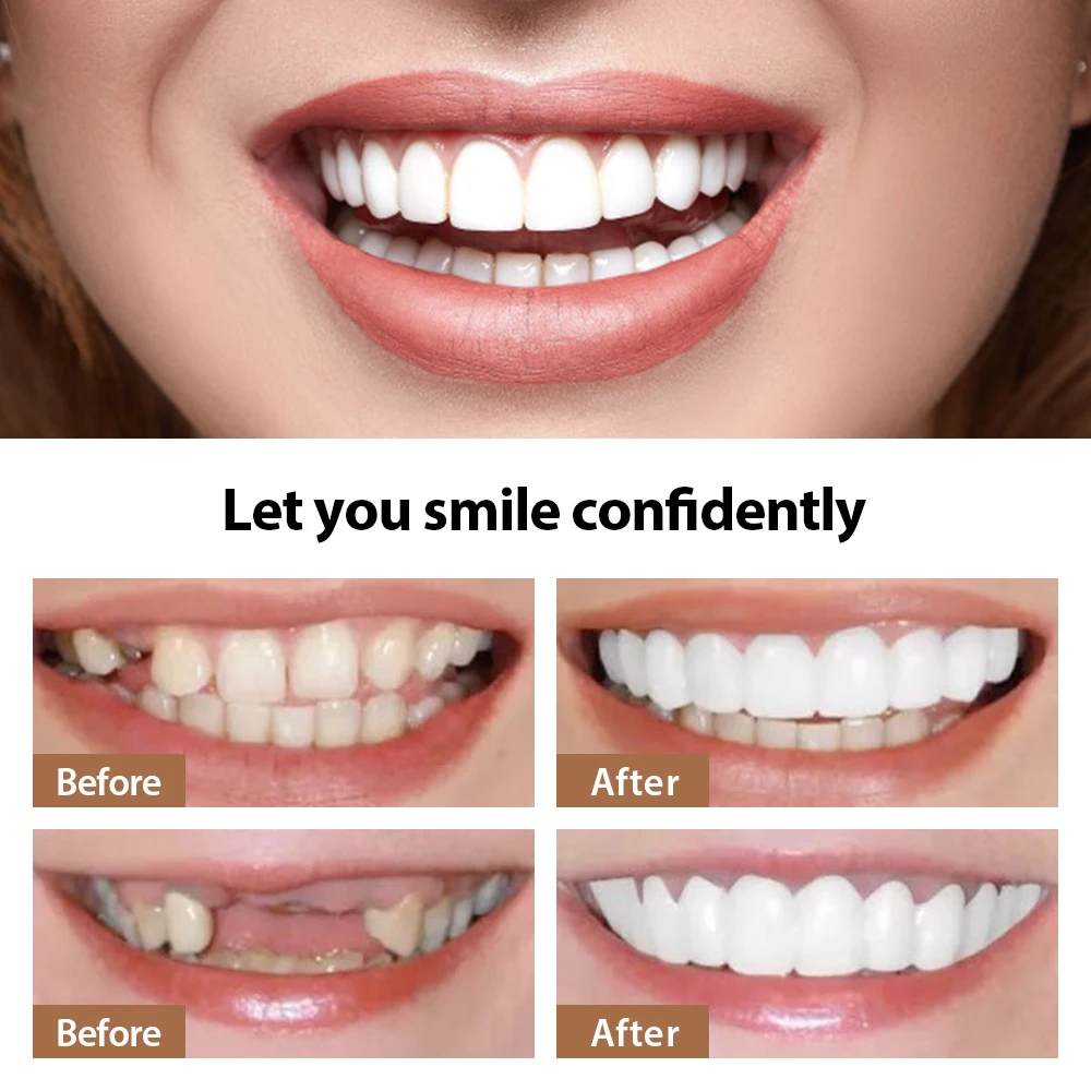 Perfect Teeth With Braces