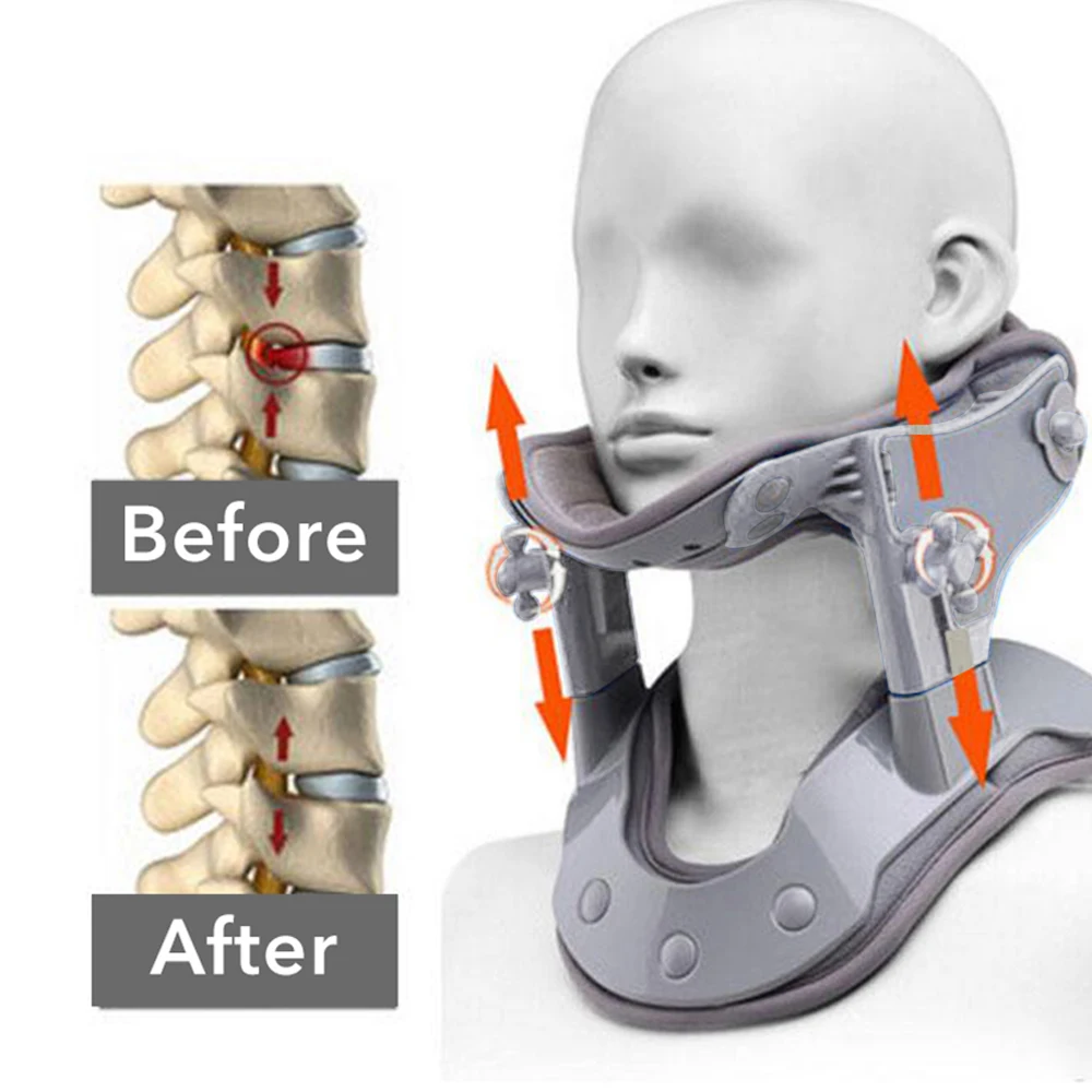 Medical-Neck-traction-device-Inflatable-Cervical-Collar-Correction-kit ...