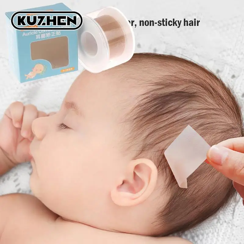 Baby-Ear-Corrector-Infant-Protruding-Ears-Correction-5-x-100cm-Silicone ...