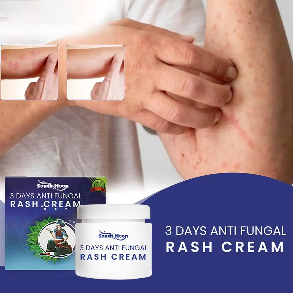 18g-Skin-Rash-Repair-Cream-Natural-Repair-Antibacterial-Ointment-For ...