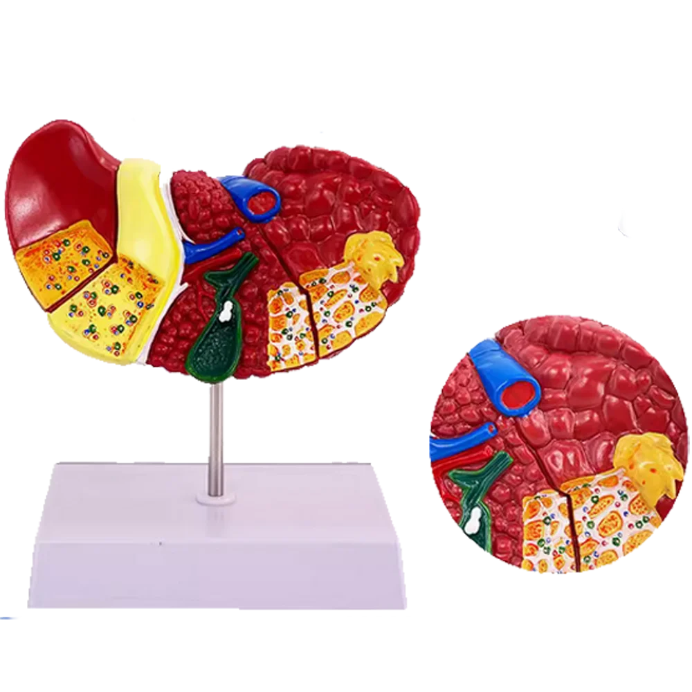 Medical-Science-Colored-Pathology-Liver-Anatomical-Model.png