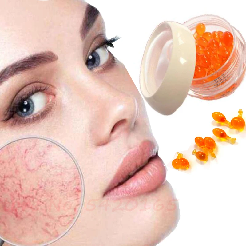 Facial-Varicose-Vein-Essence-Anti-Redness-Spider-Vein-Remover-Advanced ...