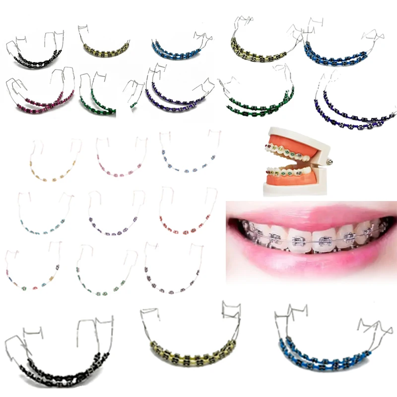 Fake Braces Clip-On: Real Experience with Colorful Temporary Tooth ...