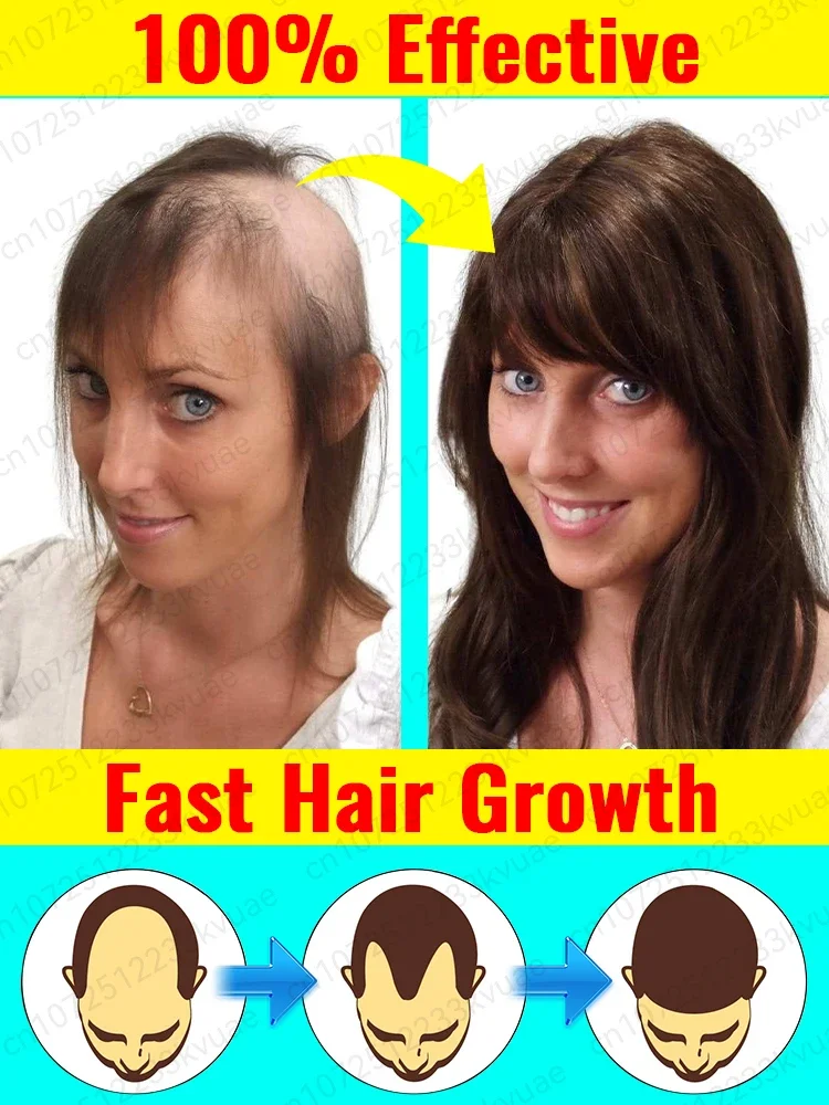 Instant-Hair-Growth-Oil-Restorer-Bald-Patch-Repair-Fast-Growing ...