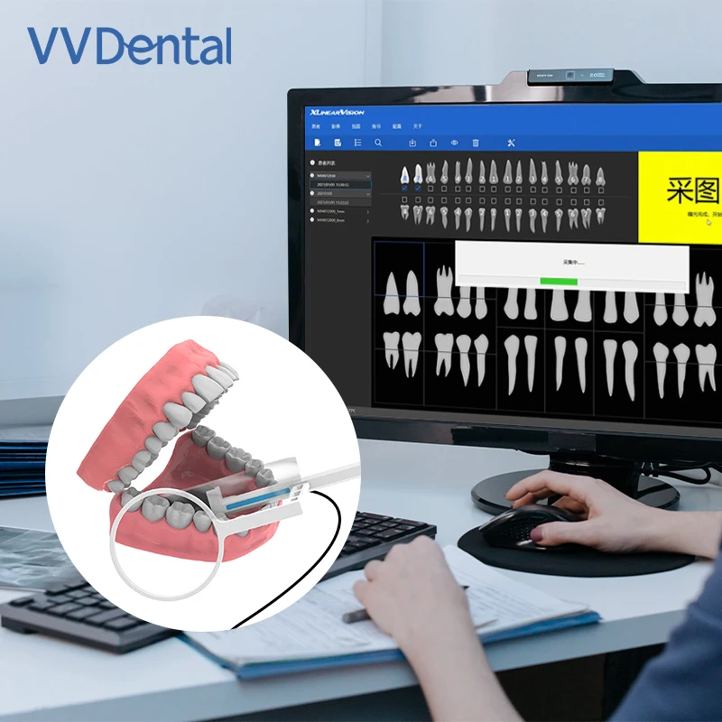 VVDental-Sensor-X-Ray-High-Frequency-Rx-Digital-Intraoral-HD-Image-Film ...