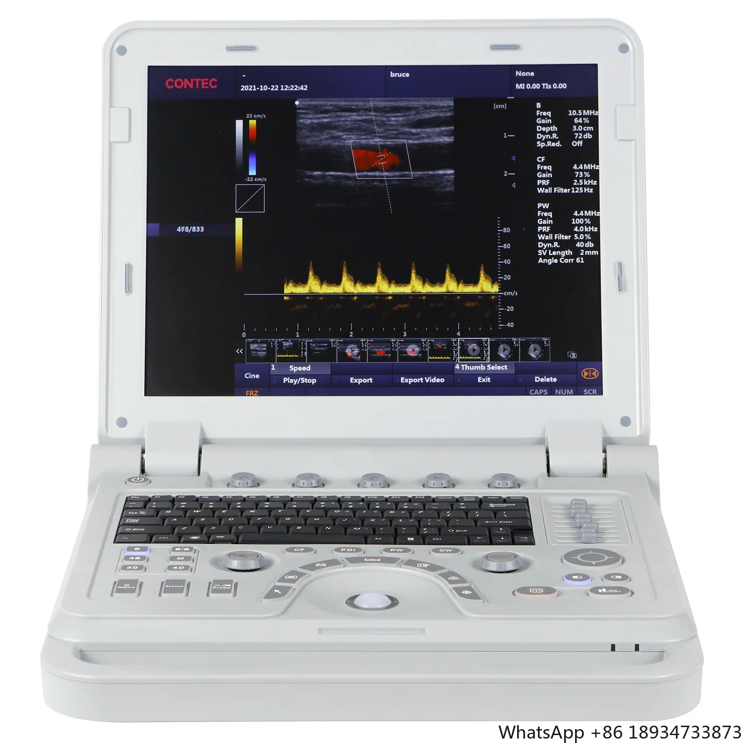 CONTEC-CMS1700B-ultrasonic-diagnostic-sonoscape-ultrasound-machine ...