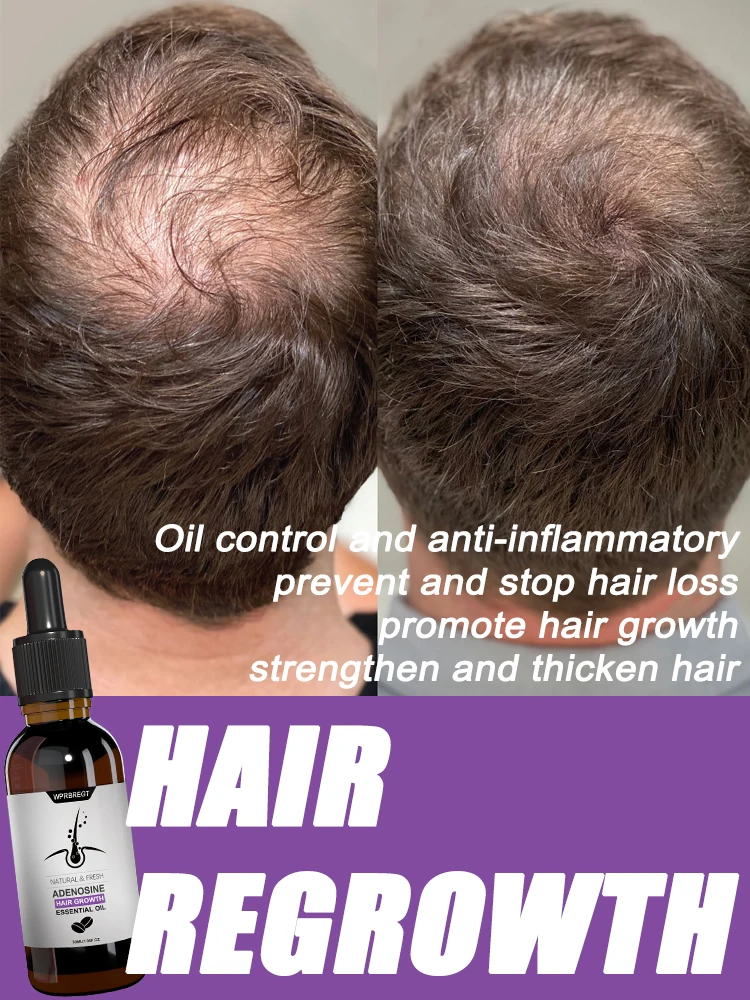 Adenosine-Hair-Growth-Serum-Products.jpg