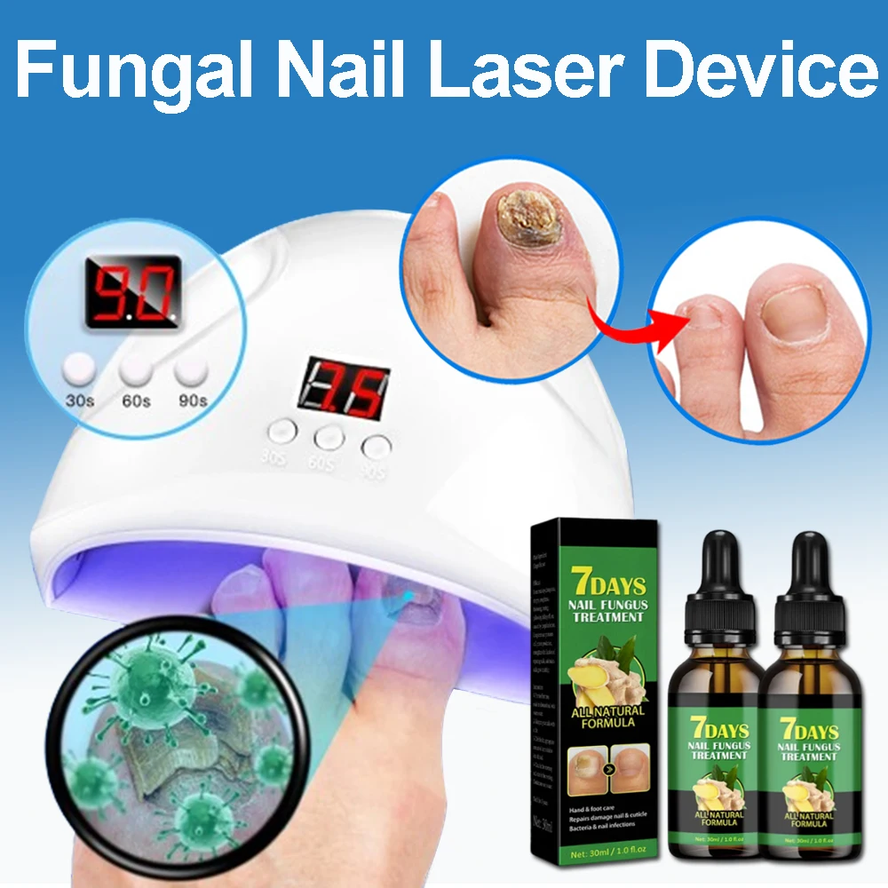 Fungal-Nail-Laser-Device-Repair-Fast-Nails-Fungus-Anti-Infection ...