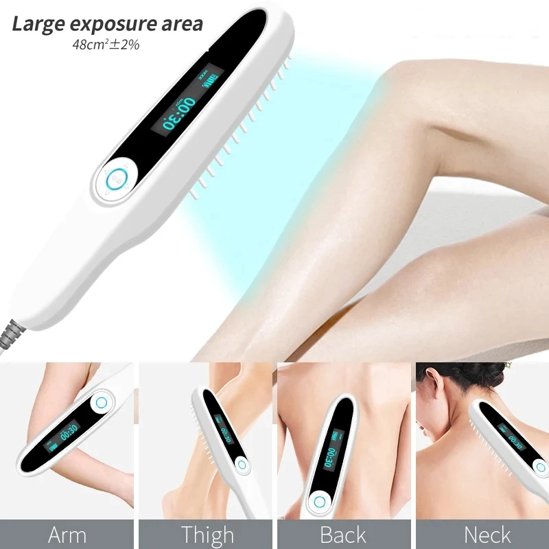 UVB Ultraviolet Phototherapy Instrument Vitiligo Treatment UV 311nm Is Recommended By Doctors To ...