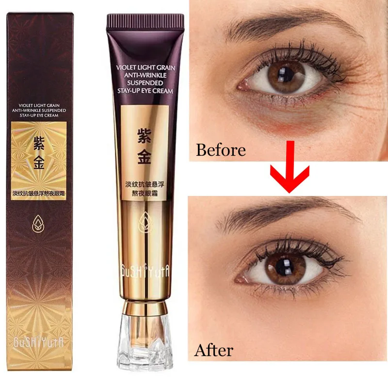 Anti-Wrinkle-Eye-Cream-Anti-Dark-Circles-Remove-Wrinkles-Fine-Lines-Eye ...
