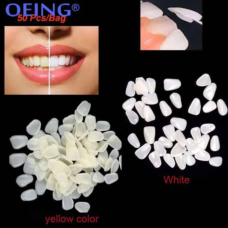 Dientes-de-resina-Dental-de-50-piezas-carillas-de-dientes-Vene-corona ...