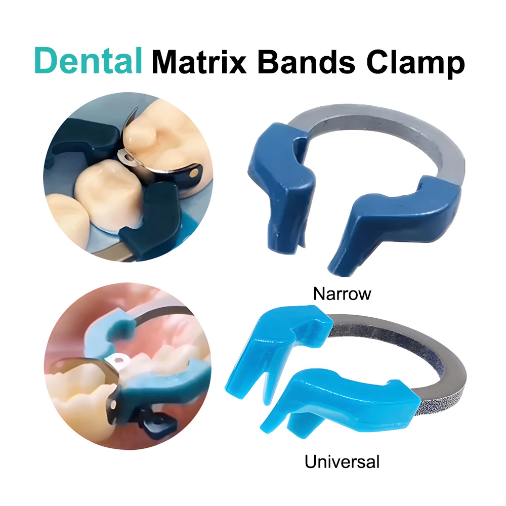 Dental-Matrix-Bands-Clip-NITI-Matrix-Clamp-Ring-Clamp-Sectional ...