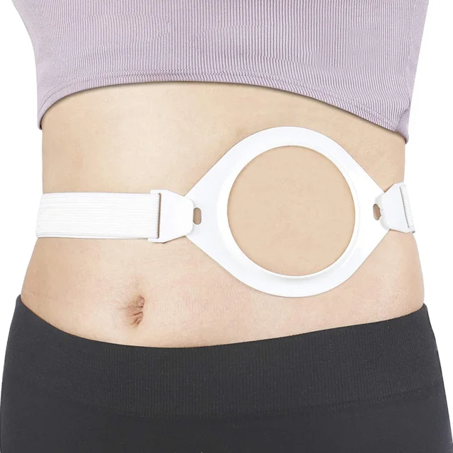 Colostomie En Boucle Diverse Stoma's • Chirurg En Operatie
