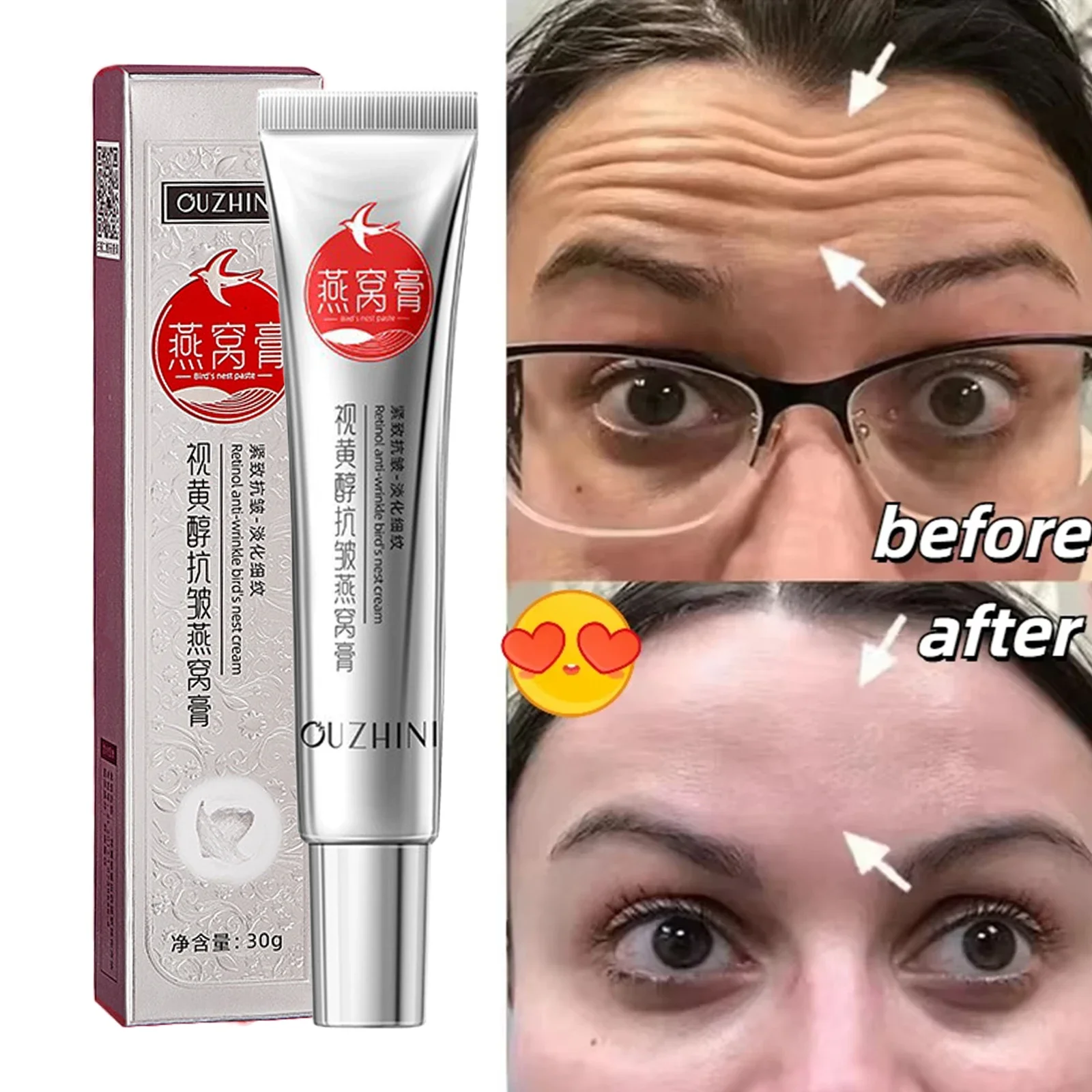 What You Need to Know About Fordyce Cream for Radiant Skin
