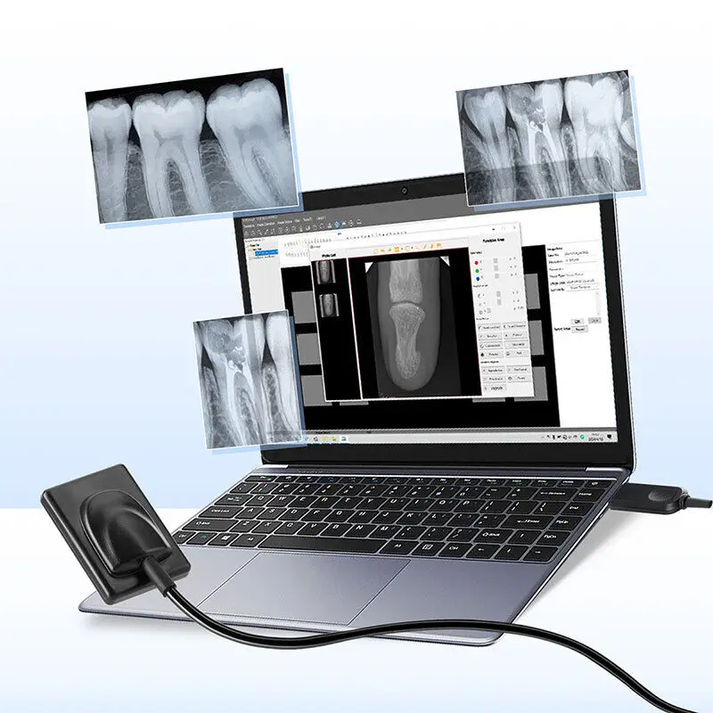 Portable-Dental-Digital-RVG-X-Ray-Sensor-Imaging-System-HD-Xray-Sensor.jpg