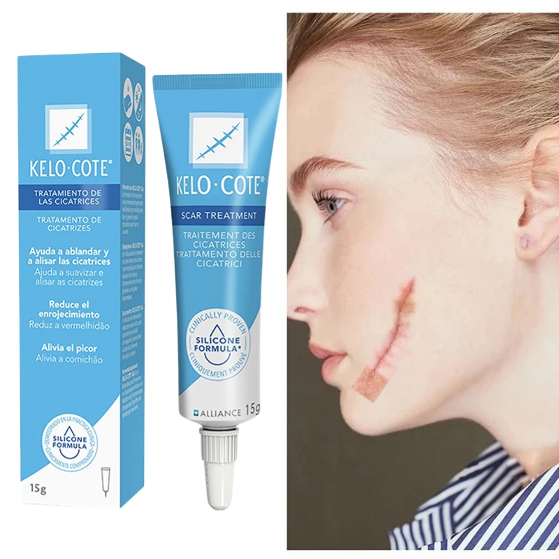 kelo-cote-Barker-Scar-Removal-Paste-Gel-Skin-Care-Stretch-Marks-Removal ...