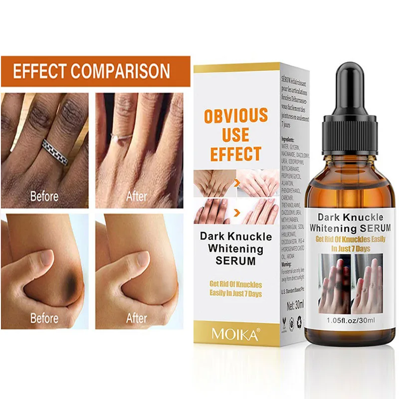 Dark-knuckle-whitening-serum-Underarm-Elbow-Knee-Bleach-Remove-Melanin ...