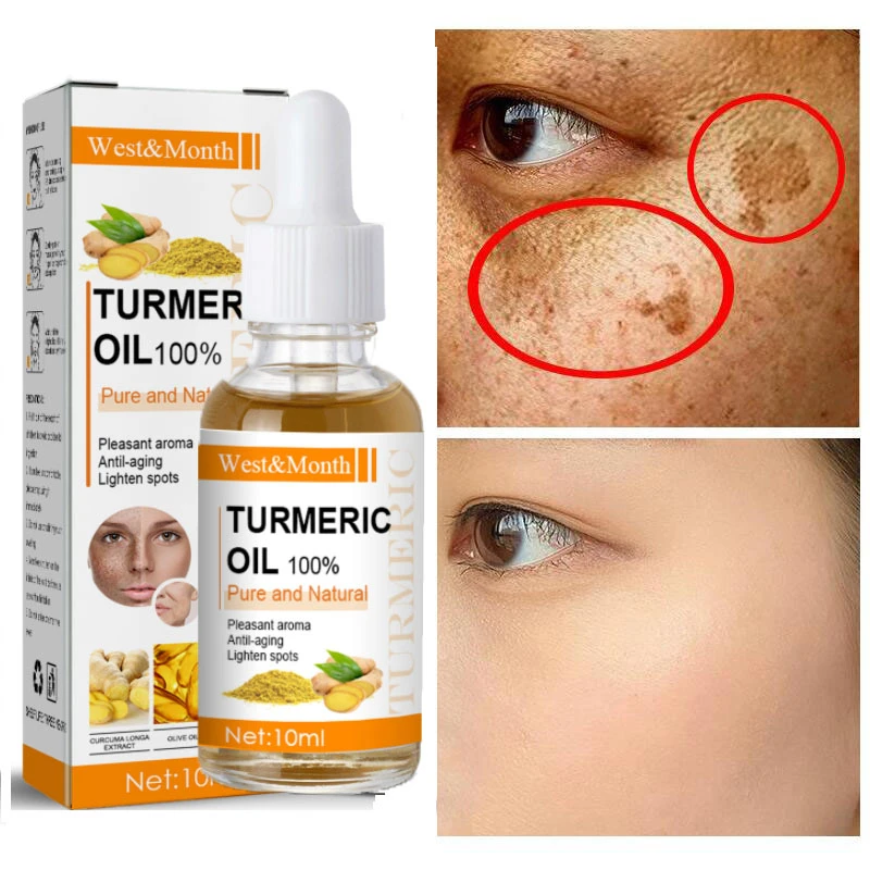 Turmeric Whitening Freckles Serum Remove Dark Spots Melasma Brighten ...