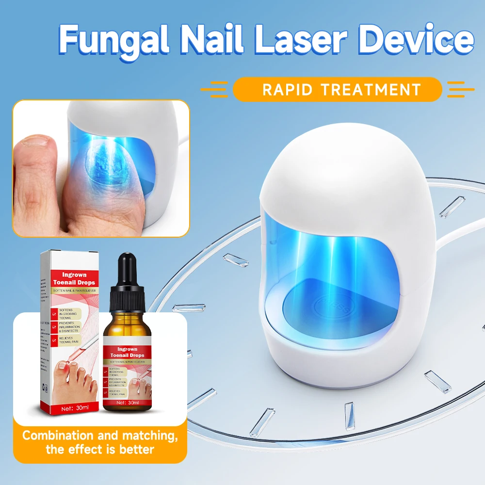Nail-Fungus-Laser-Treatment-Device-Fungal-Treatment-Feet-Care-Essence ...