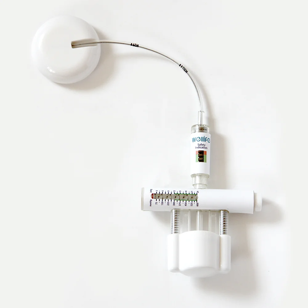 Vacuum Extractor Obstetrical: What You Need to Know About Customized ...
