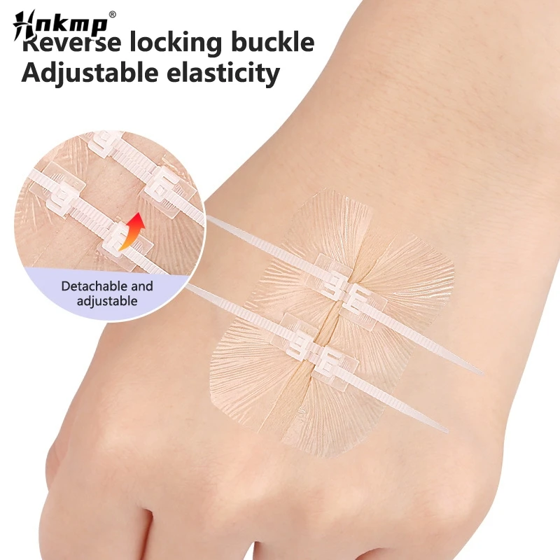 Zip Stitch Wound Bandages Emergency Wound Closures Adhesive Seamless ...