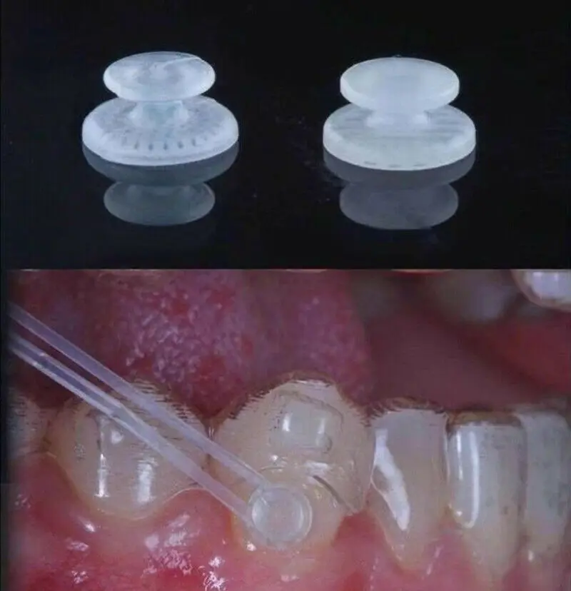Dental-Lingual-Ceramic-Round-Adhesive-Button-Brace-Retainer-Clear.jpg