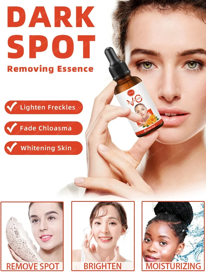 Dark-Spot-Remover-Essence-Fade-Freckles-Melasma-Chloasma-Age-Spots ...