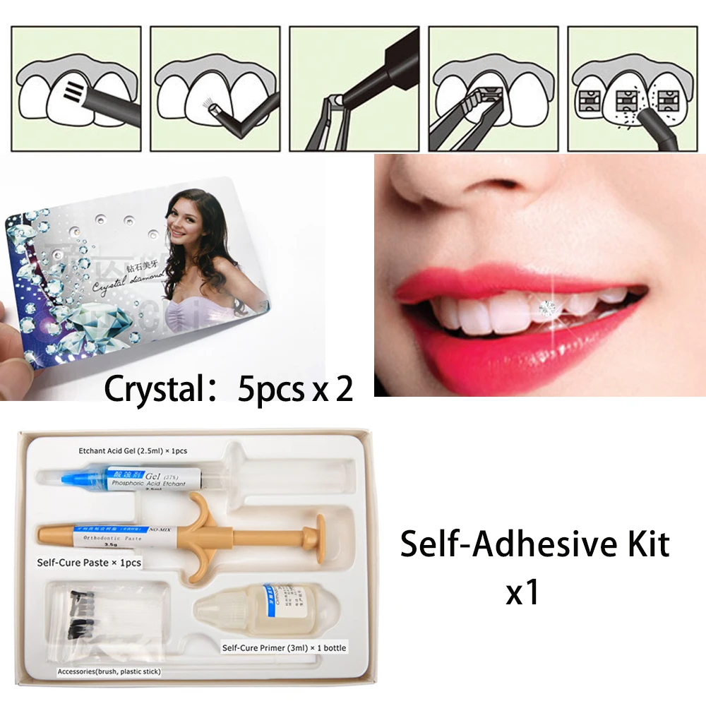 Dental Rhinestone Kit With Glue Self Adhesive Cure Cement Bonding Paste ...