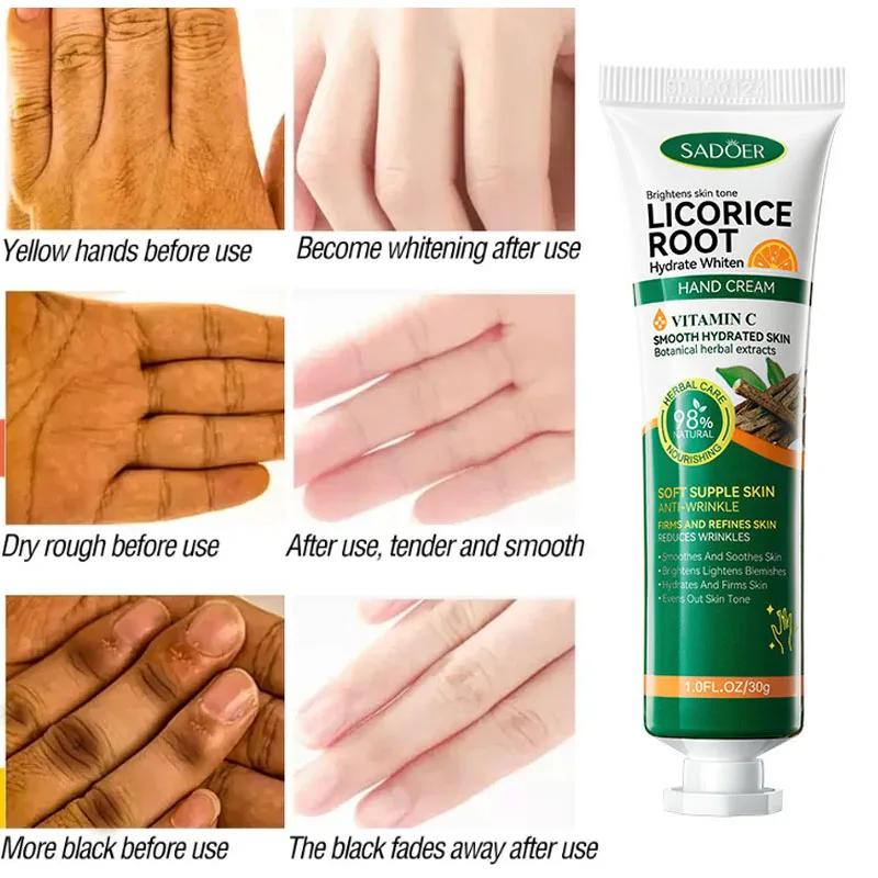 Fast-Whitening-Dark-Knuckles-Brighten-Hand-Cream-Melanin-Corrector ...