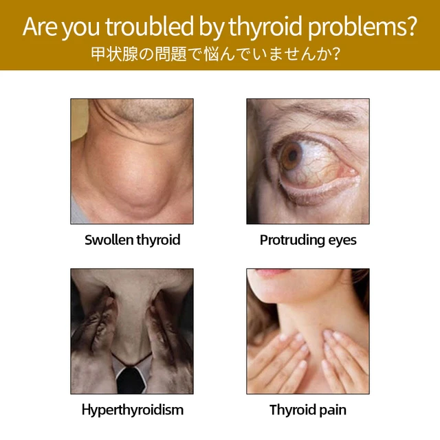 Hyperthyroidism Neck
