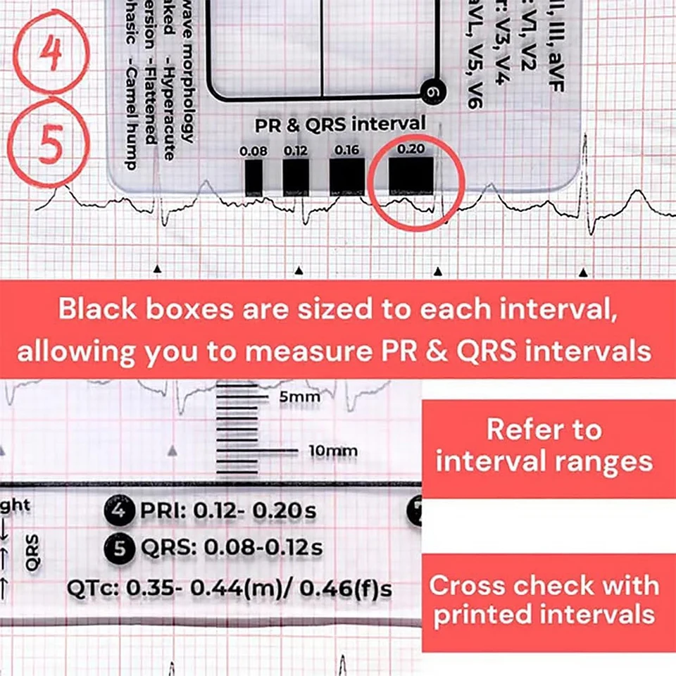 7 Step EKG Interpretation ECG 7-Step Ruler & EKG Calipers - 2 Pack ...