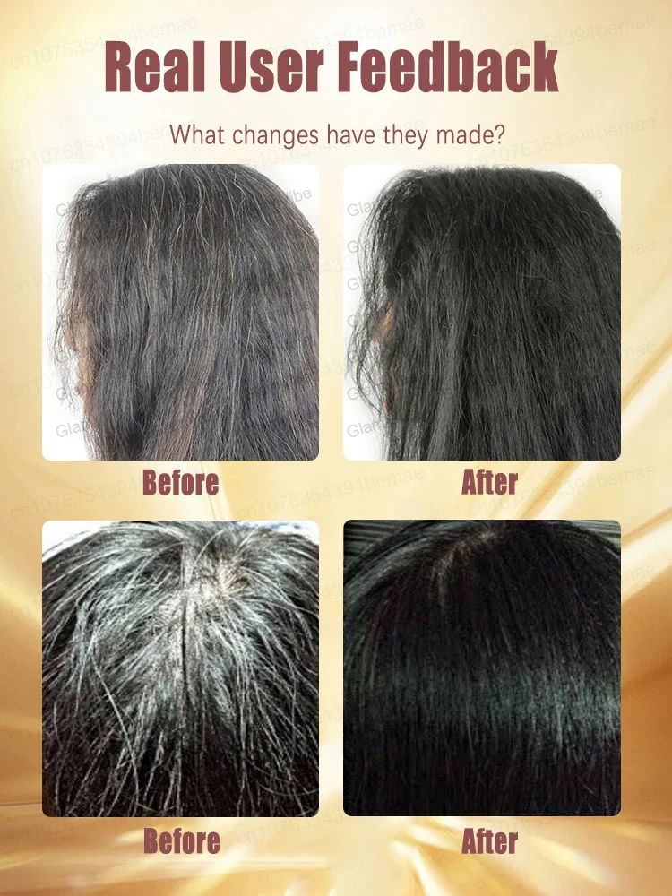 Cure gray recognized hair turn gray