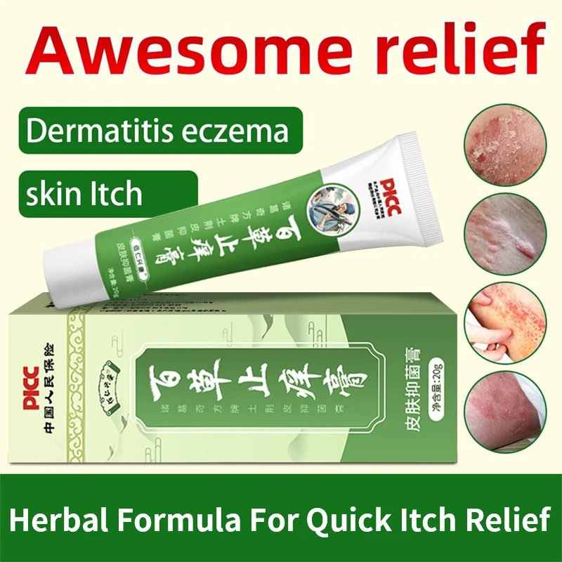 20g-Herbal-Psoriasis-Cream-Skin-Rash-Cream-Eczema-Ointment-Skin-Allergy ...
